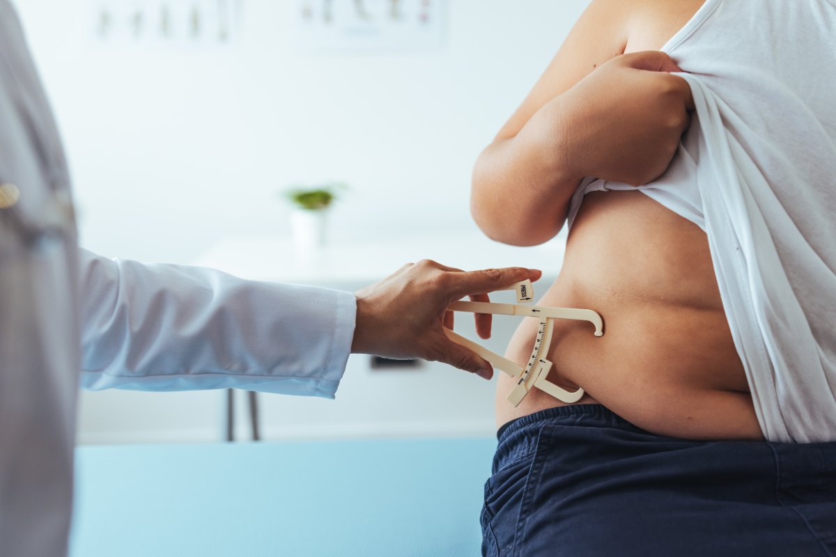 Obesidade: Tratamentos e cuidados essenciais | Panvel